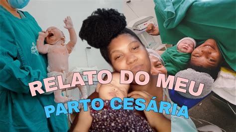 RELATO DO MEU PARTO CESÁRIA BANHO DE LUZ 39 SEMANAS YouTube