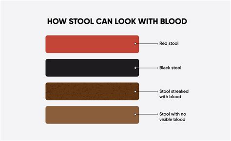 What Blood In Your Stool Could Mean Kettering Health