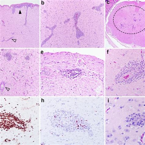 Histology Of Representative Lesions In The Nervous Tissue Of Muscovy