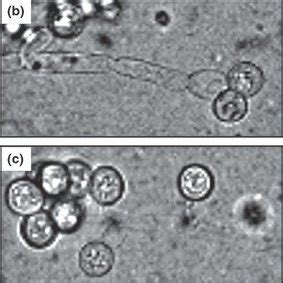 Morphology Of C Albicans And C Dubliniensis Chlamydospores A