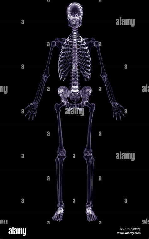 Radiografía de cuerpo completo fotografías e imágenes de alta