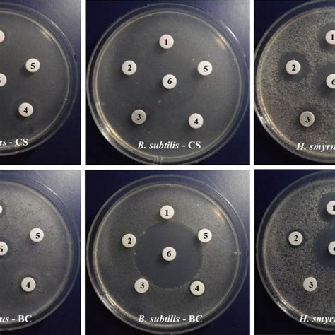 Steps of colony picking method ① Spreading test bacteria on agar