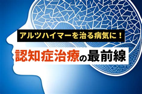徹底解説認知症治療の最前線 エーザイなど製薬企業が開発する薬物療法の作用機序非薬物療法検査技術の最新動向
