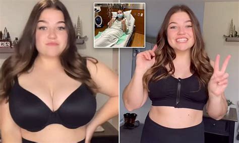 Woman Whose Size H Breasts Led To A Cyst On Her Spine Shows Off Her New