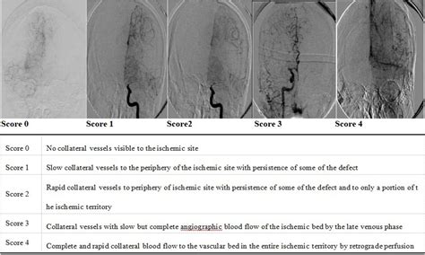 The Relationship Between Neutrophil To Lymphocyte Ratio And Cerebral