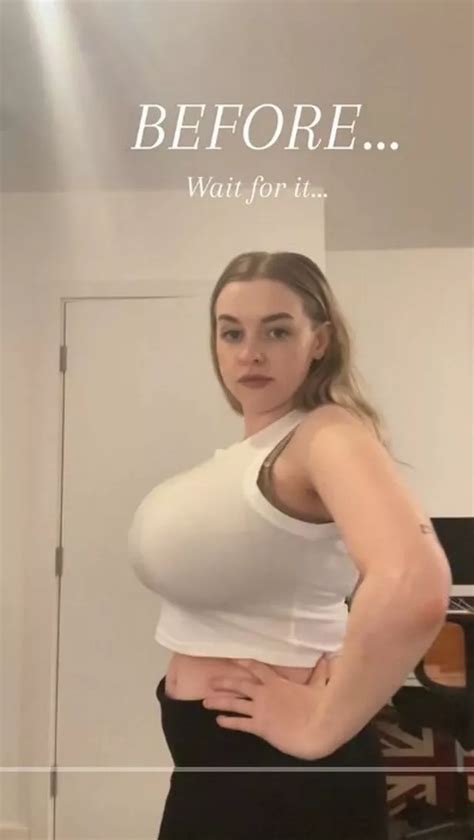 My Big Boobs Made Me Hunchback For Years But I M A Brand New Person