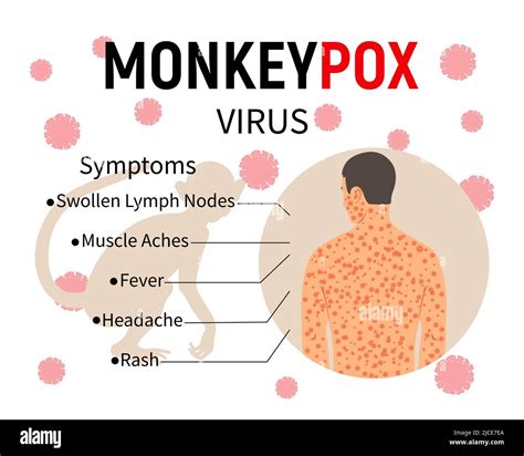 Infografica Sui Sintomi Di Monkeypox Banner Con Testo Silhouette Di