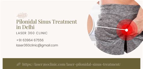 Troubled By Pilonidal Sinus Avail Of Assured Treatment At