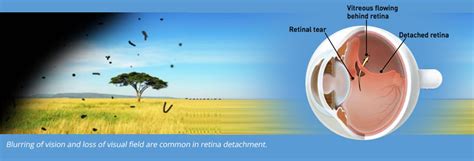 Welcome To Indah Specialist Eye Centre