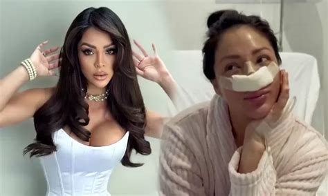 Sheyla Rojas se sometió a nueva cirugía de nariz Adiós a mi tabique