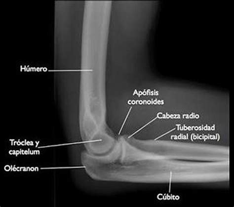 1 radiografia anatomia codo Ocronos Editorial Científico Técnica