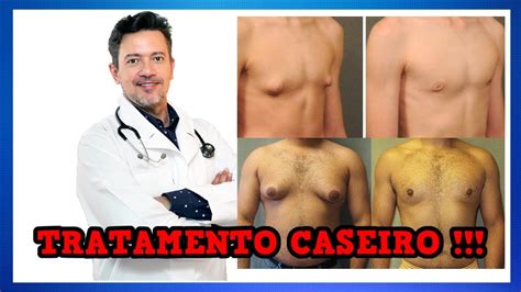 Ginecomastia Grau Tratamento Caseiro Ginecomastia Grau Youtube