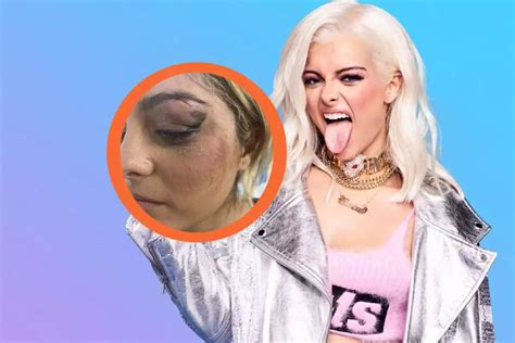 Avienta Hombre Un Celular A Bebe Rexha En Pleno Concierto Y Le Hiere La