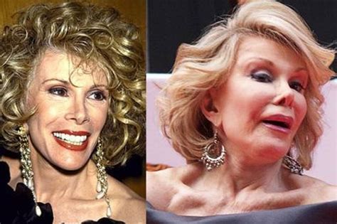 Les résultats de la chirurgie esthétique en 10 photos avant après