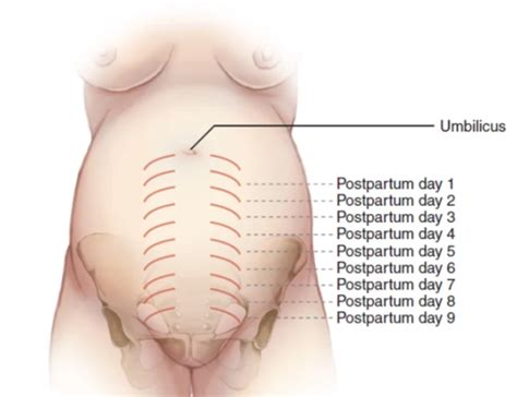 Chapter 15 Postpartum Adaptations Flashcards Quizlet