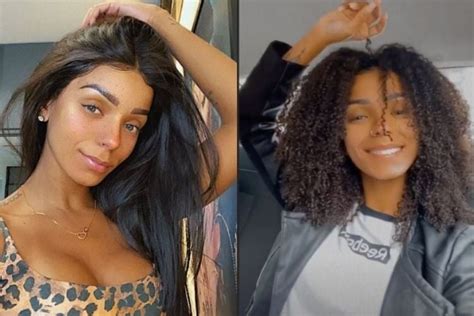 Brunna Gonçalves antes e depois veja resultados de procedimentos da