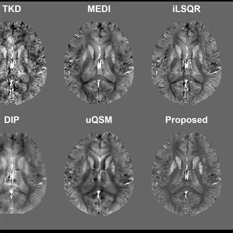 qsm reconstruction results of aloha qsm data using various methods download scientific diagram