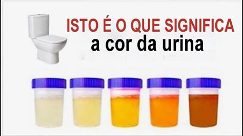 A cor do seu xixi pode indicar problemas de saúde saiba o que pode