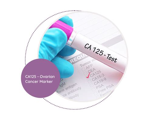 CA125 Ovarian Cancer Marker MediScan Lab