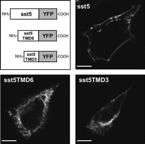 Subcellular Localization Of Full Length And Truncated Psst5 Variants