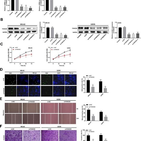 FANCD2 Silencing Inhibits Cell Proliferation Migration And Invasion