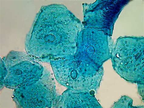 Cheek Cells Under Microscope 400x
