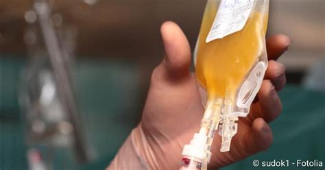 Hämophilie Ursachen Behandlung Medizin Blog von Praxis Knochen