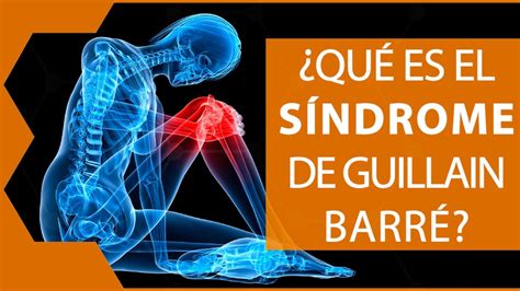 Qué es Guillain Barré síntomas causas y tratamiento
