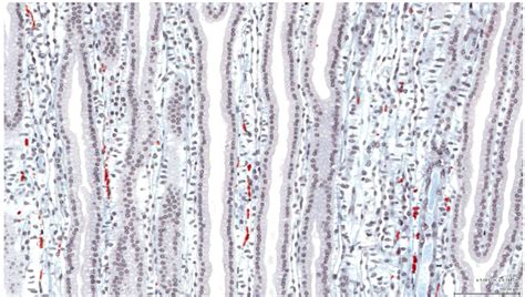Diagram Of Urinary Histology Renal Medulla Quizlet