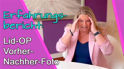 Augenlid OP Erfahrungsbericht Vorher Nachher Ergebnis Nach Lid OP
