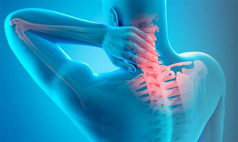 Symptoms Of Bulging Disc In Neck C5 C6 Performance Pain And Sports