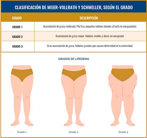 Tipos De Lipedema