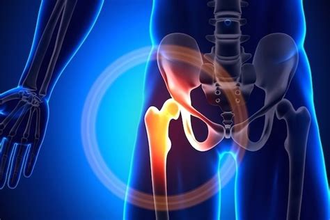 Dor no quadril 6 causas comuns e o que fazer Tua Saúde