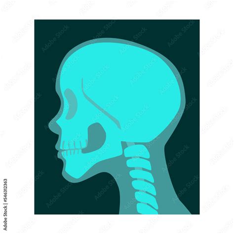 Ray Of Human Skull Side View Vector Illustration Bones Of Skeleton