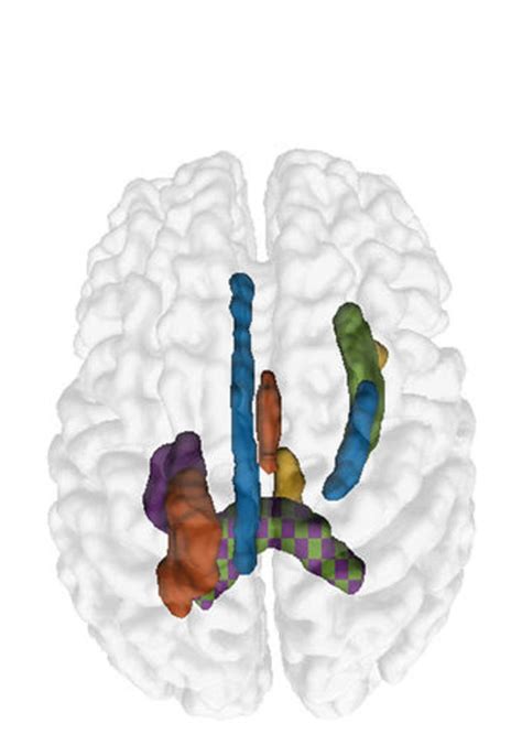 Vast Diversity Of Human Brain Cell Types Revealed In Trove Of New