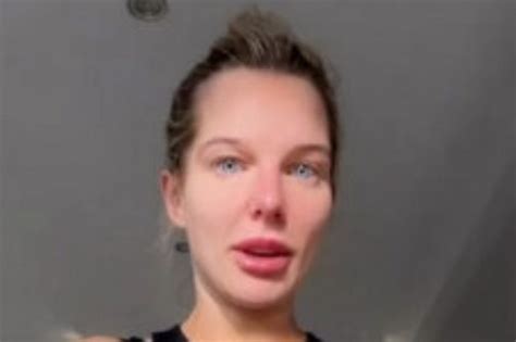 Helen Flanagan Admits I Need To Switch Off As Fans Rush To Support