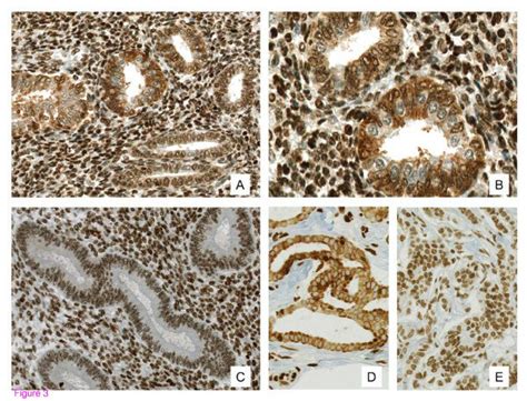 Expression Of The G Protein Coupled Estrogen Receptor GPER In