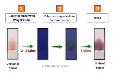 Wright S Stain Procedure Principle Components Uses And Blood Smear