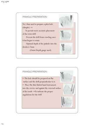 Pin Retained Amalgam Restorations Pdf