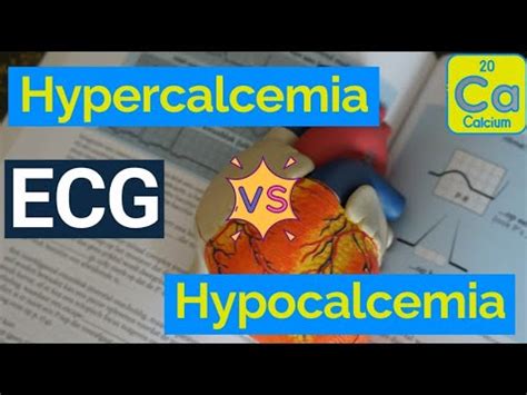 ECG Changes In Hypercalcemia Vs Hypocalcemia The Cardiac Consequences