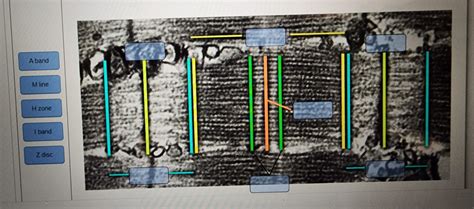 Solved Identify The Regions Of The Sarcomere Note That Chegg