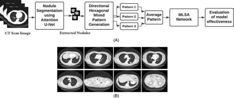 a the block diagram of the three major stages of the proposed lung download scientific