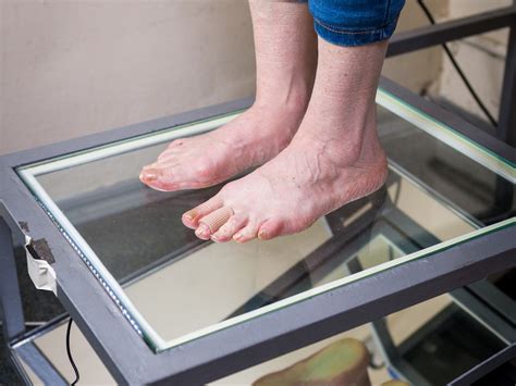 Custom Orthotics Central Coast East Gosford Podiatry