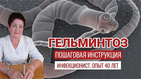 Гельминтоз как избавиться от глистов без таблеток Инструкция от
