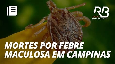 CAMPINAS alerta para contágio e investiga mortes por FEBRE MACULOSA