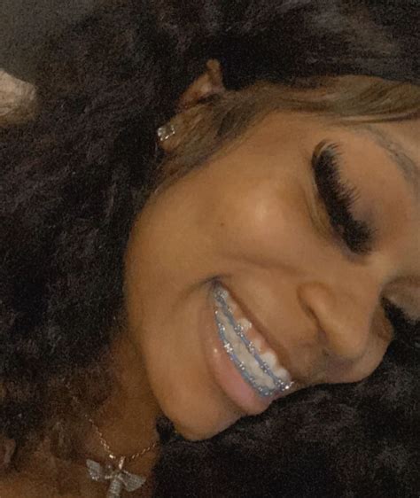 Pin By HoodPrincess On Pwetties Braces Colors Dental Braces