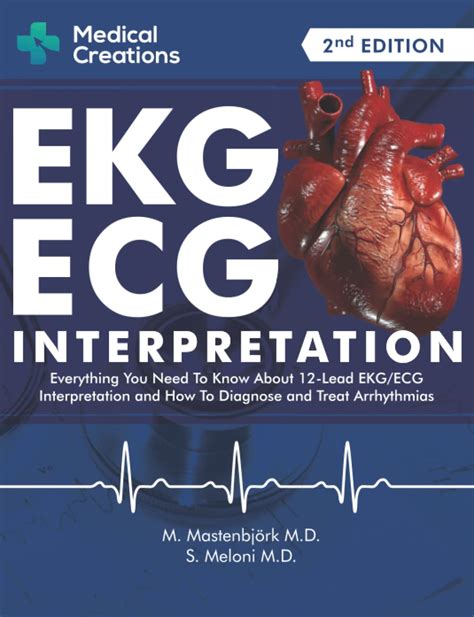 Ekg Ecg Interpretation Everything You Need To Know About The Lead
