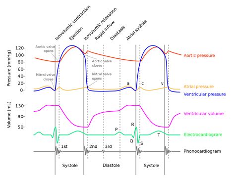 Heart Murmurs Clinical Features Geeky Medics