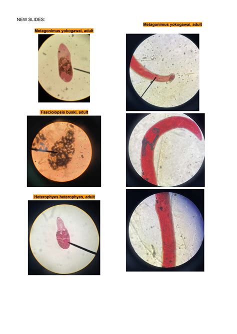 SOLUTION Copy Of Parasitology Trematodes Nematodes Cestodes Practical