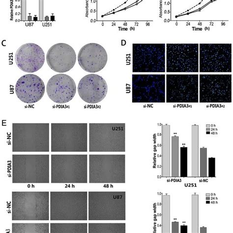 Effects Of PDIA3 On Glioma Cell Proliferation Apoptosis And Migration